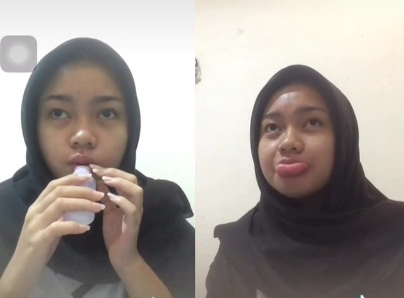 Viral Wanita Coba Tebalkan Bibir Pakai Botol Yakult, Endingnya Bikin ...